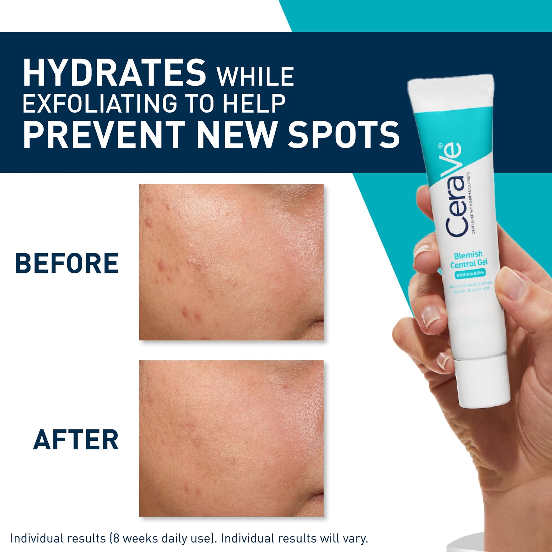 Cerave Acne Control Gel 40ml - Beautiegen